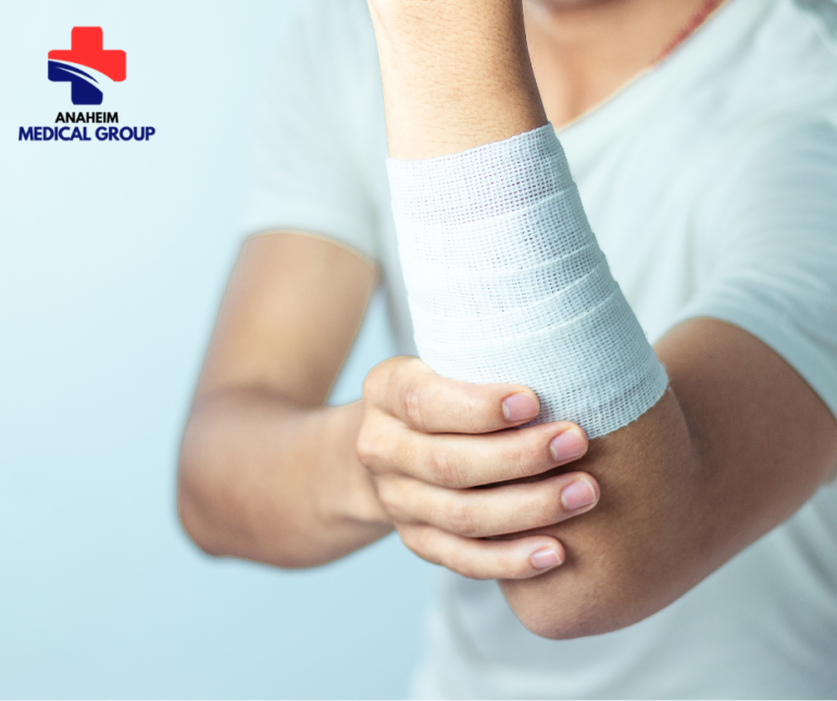 Minor Cuts And Wounds In Anaheim: Walk In Now For Help